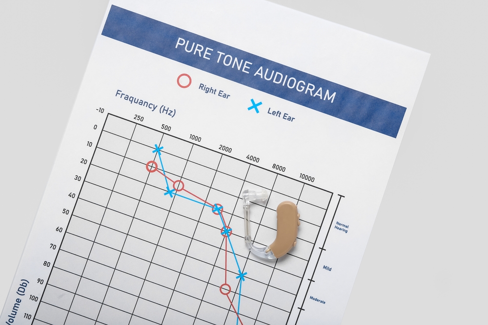 Understanding Your Audiogram A Simple Explanation - Broadwater Hearing Care